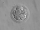 Stages of Embryonic Development – Morula IVF