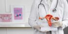 10 Jenis Kista yang Paling Umum – Morula IVF